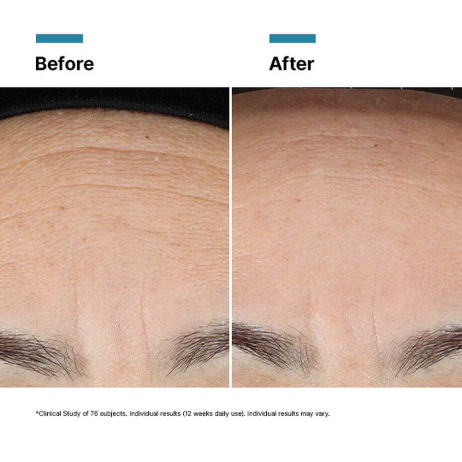 Advanced RGN-6 Skin Rejuvenation Patented Cream | SkinCeuticals