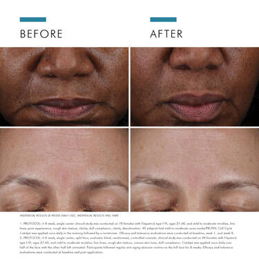 Cell Cycle Catalyst Exfoliating Anti-Ageing Serum | SkinCeutical UK