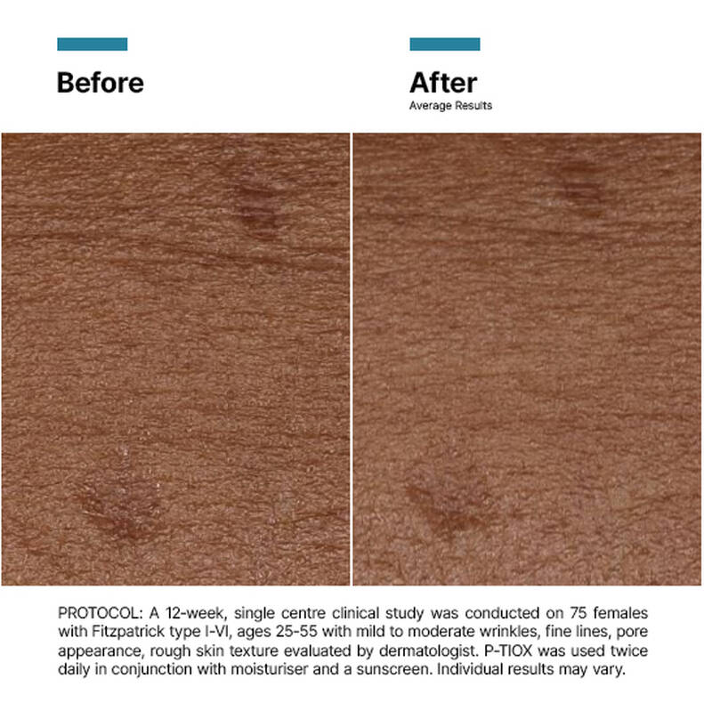 P-TIOX Anti-Wrinkle Serum | SkinCeuticals