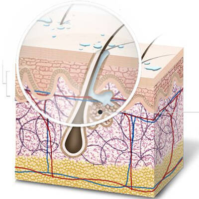 What Are The Causes of Oily Skin | Skincare Advice | SkinCeuticals